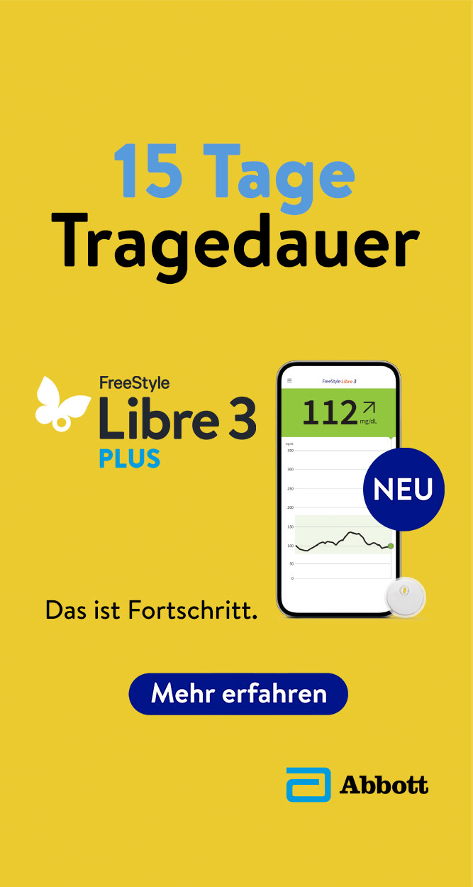 Cam APS FX mit Ypso: Automodus nur in der Nacht? - Closed Loop Systeme ...